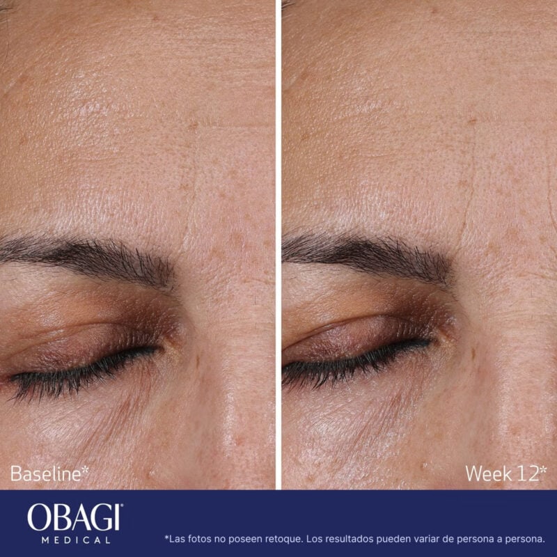 ELASTIderm Advanced Filler Concentrate | Obagi | Líneas Finas